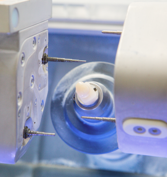 Аппаратный комплекс CEREC XL inLab - центр стоматологии «Тихонова» в Туле